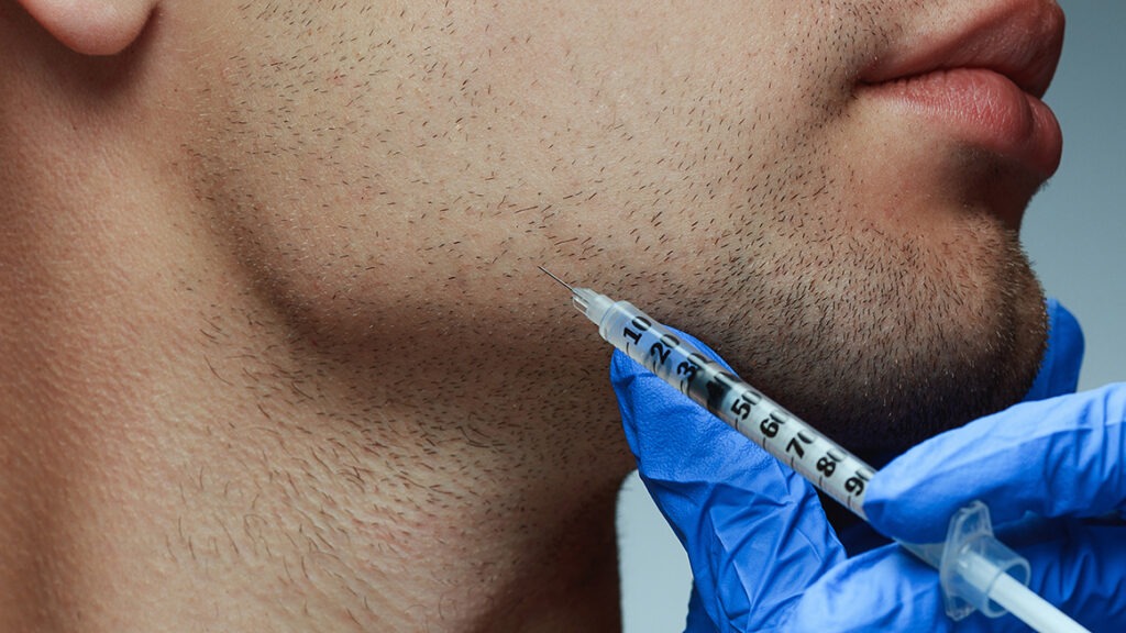 Here's The Botox or Jeuveau Guide For Your First Injection.